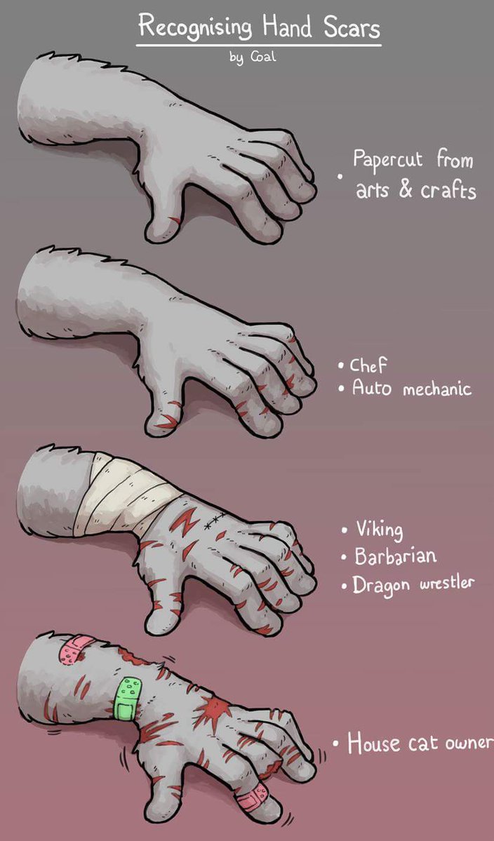Recognizing hand scars... guess which one is the worst